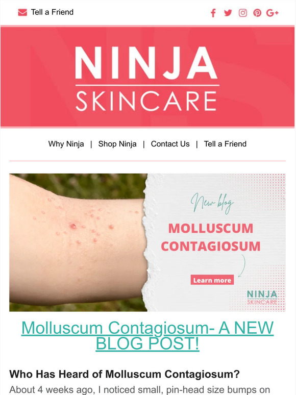 Ninja Skincare: Molluscum Contagiosum - Skin Virus | Milled