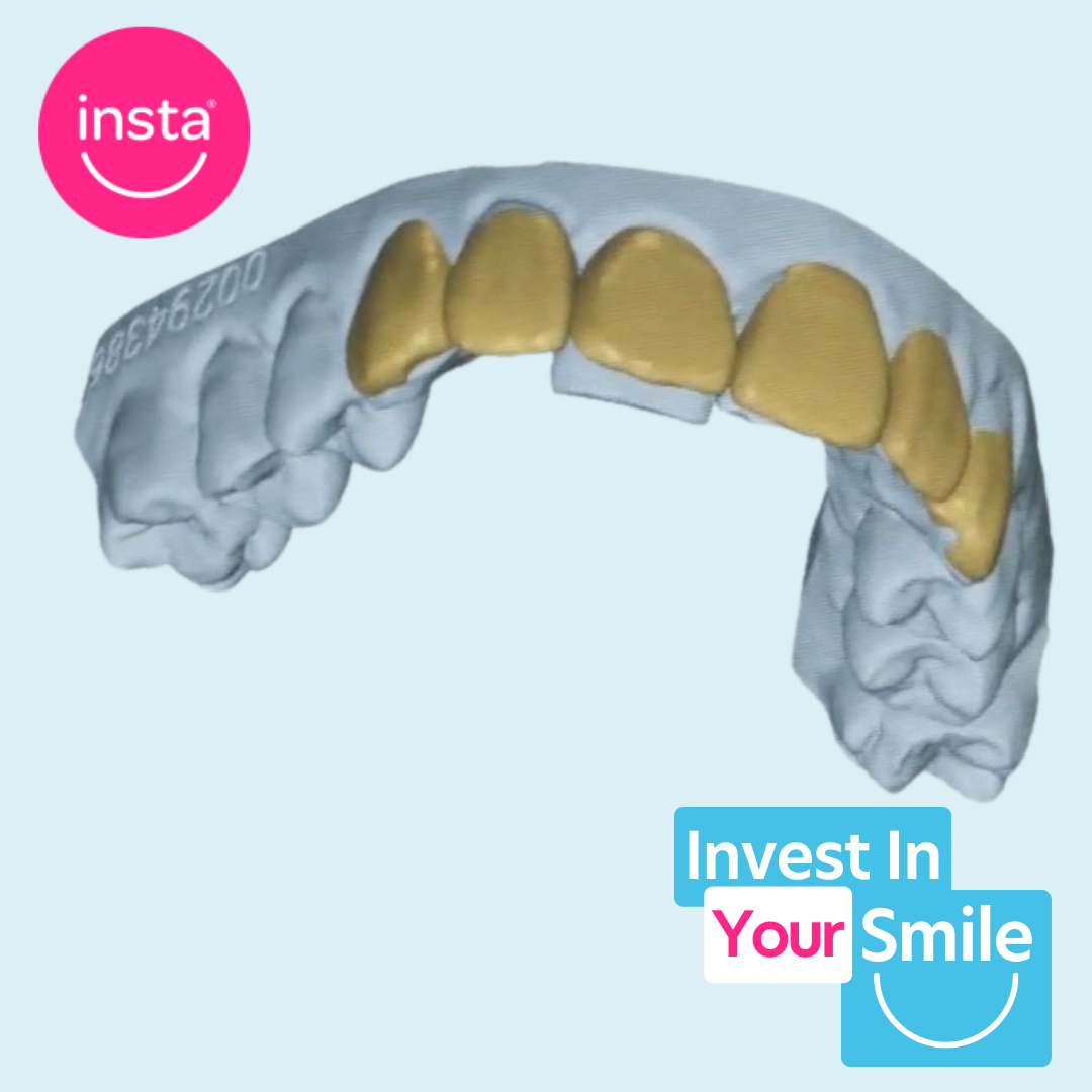 INSTAsmile: 7 simple steps to YOUR perfect smile 😀 | Milled