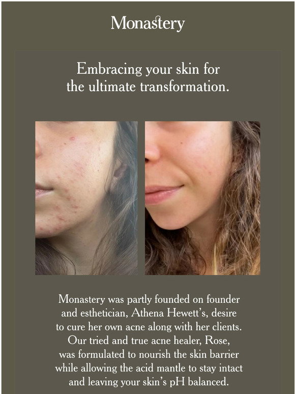 Monastery: Complete Skin Transformation | Milled