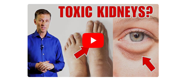 Dr. Berg: Know the 7 warning signs that your kidneys are toxic | Milled