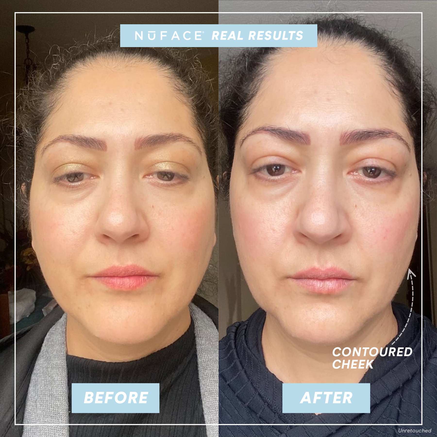 NuFACE: Save $105 on the All-In-One Trinity Complete Set | Milled