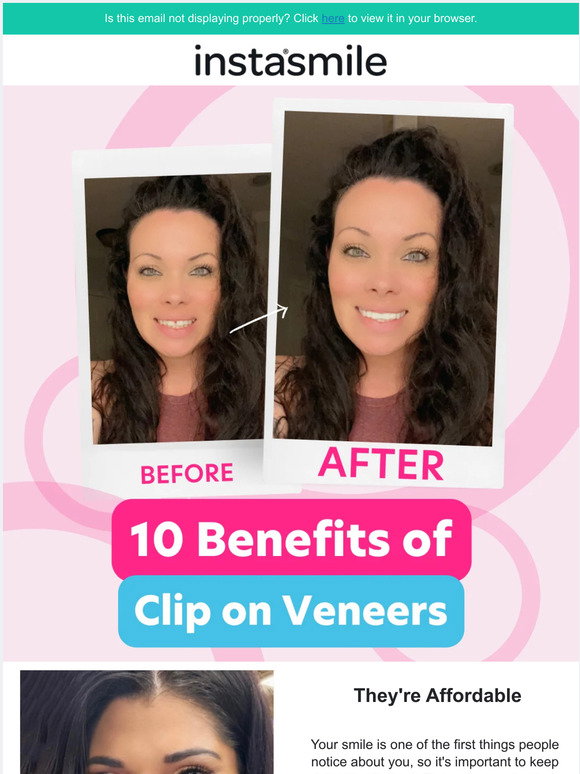INSTAsmile: — 10 Reasons YOU Should get Clip-On Veneers 😍 | Milled