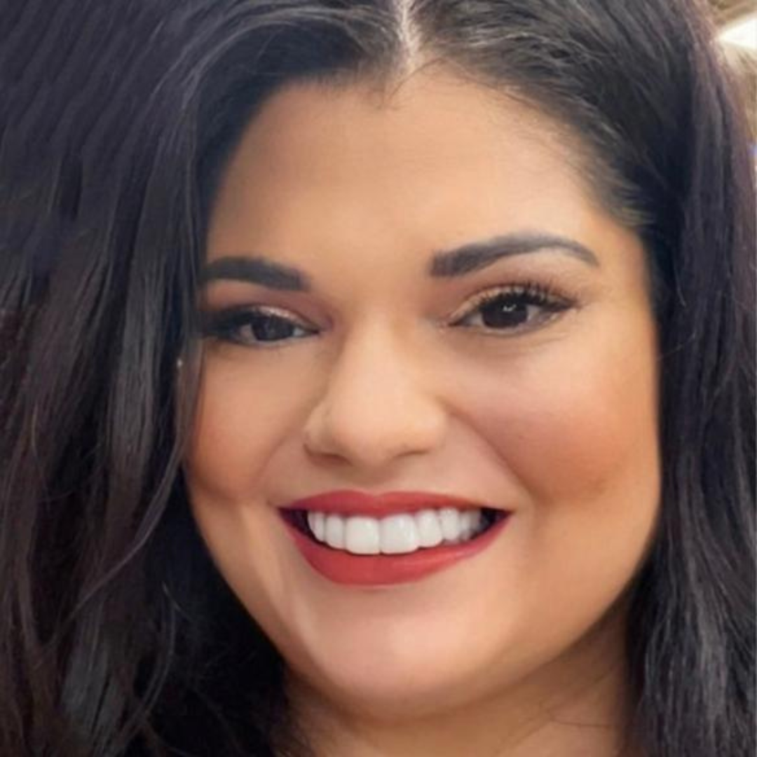 INSTAsmile: — 10 Reasons YOU Should get Clip-On Veneers 😍 | Milled