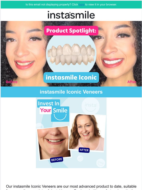 INSTAsmile: — Check out our Most Iconic Veneer Yet! 🤩 | Milled
