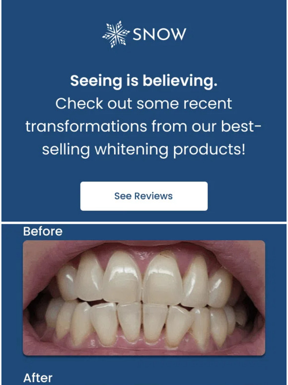 SNOW: Peep those teeth 👀 | Milled