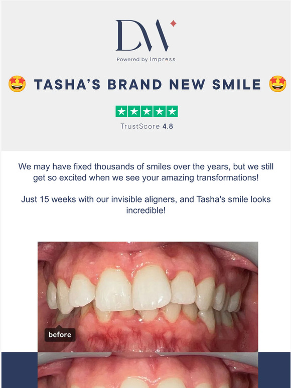 Diamond Whites: WOW! Look @ Tasha’s Smile Glow Up 🤩 (Before/After) | Milled