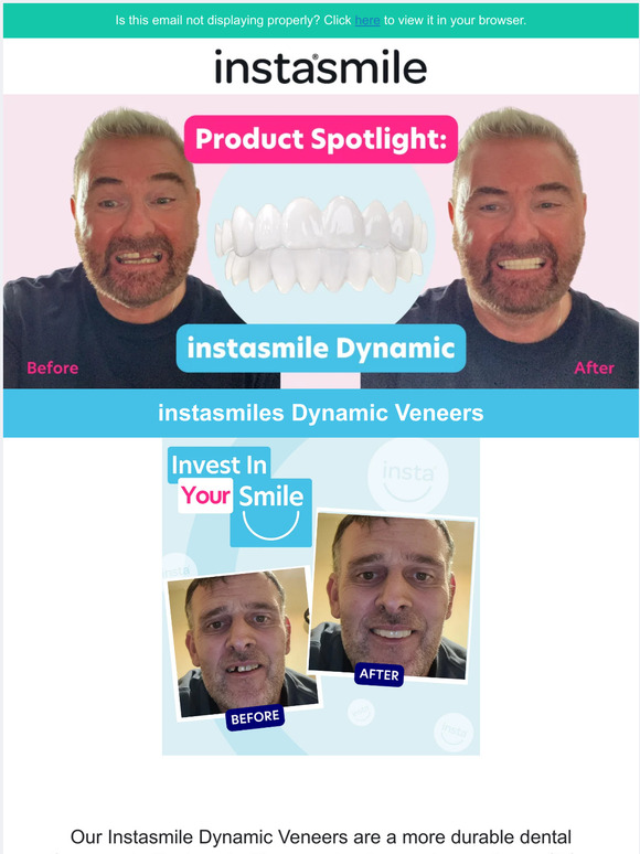 INSTAsmile: — Learn More About our Dynamic instasmile 🦷 | Milled