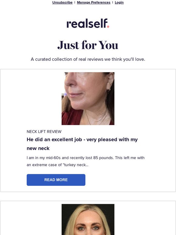 RealSelf: Read this new neck lift review | Milled