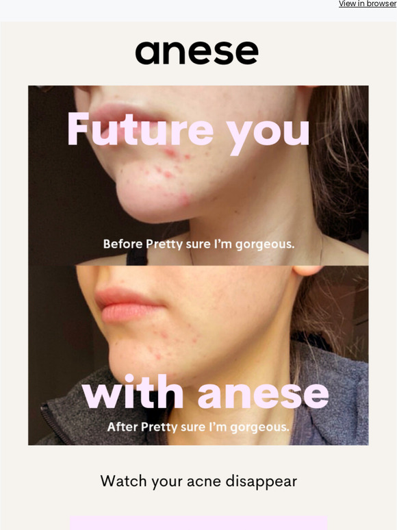 Anese: Future you... | Milled