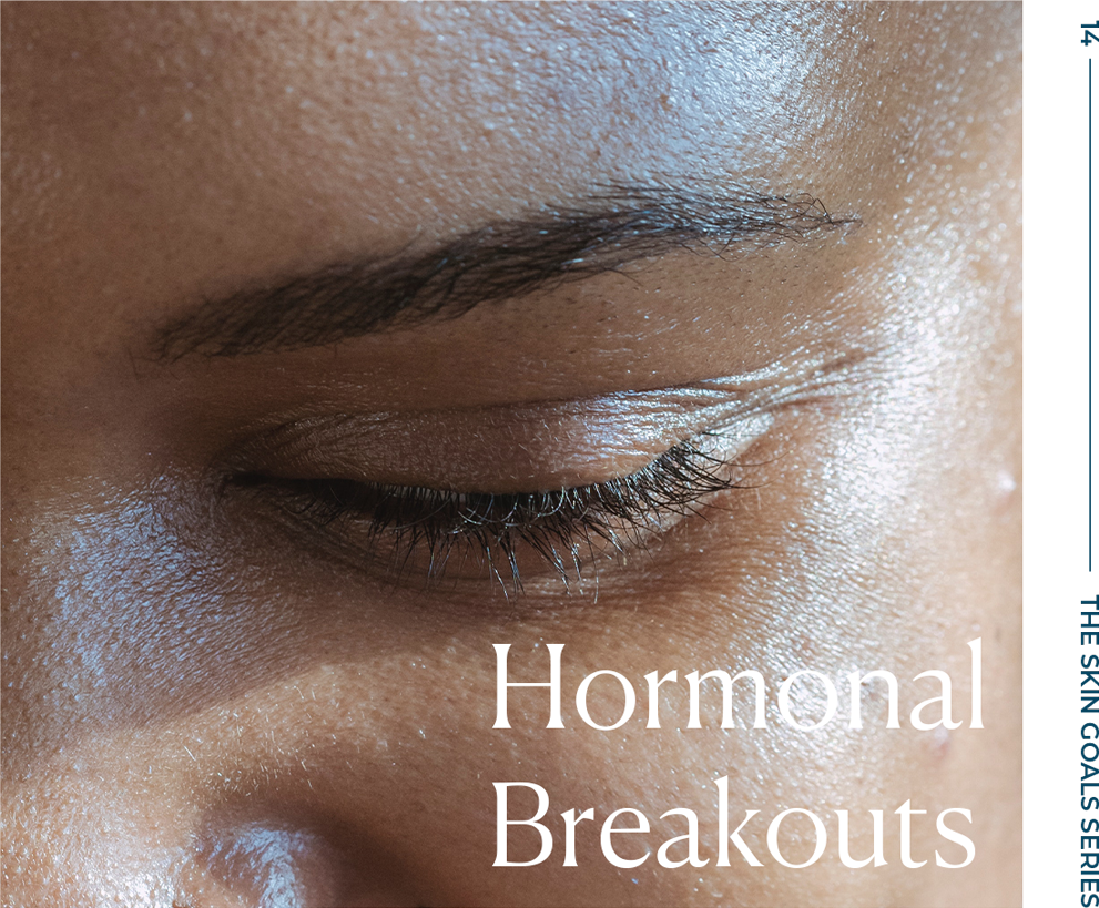 Elemis: 3 Steps to Beat Hormonal Breakouts | Milled