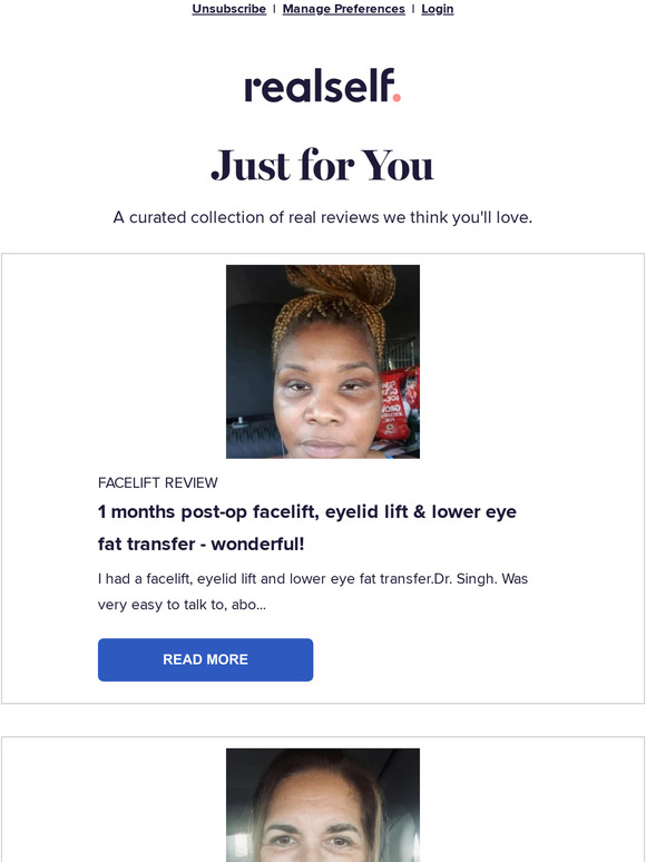 RealSelf: People share their facelift stories | Milled