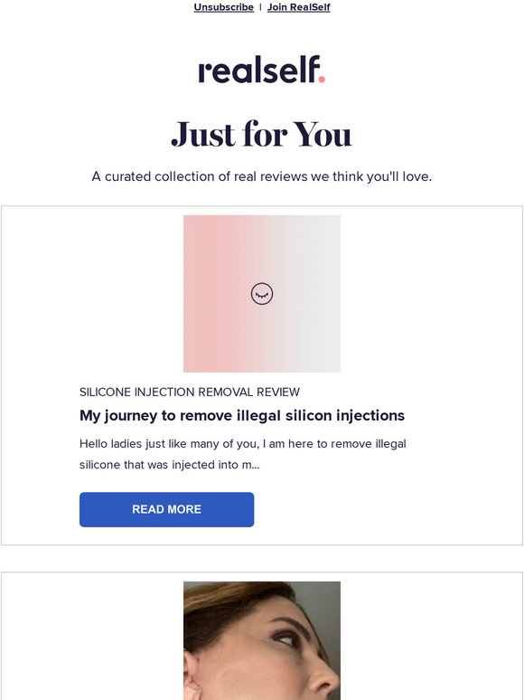RealSelf: Silicone Injection Removal: Up close and personal | Milled