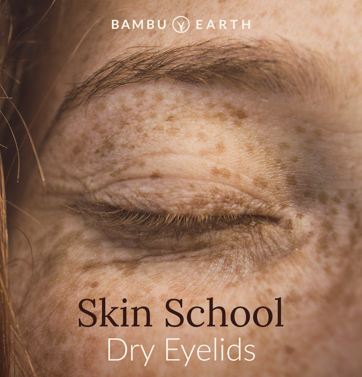 Bambu Earth: Skin School: Dry Eyelids | Milled