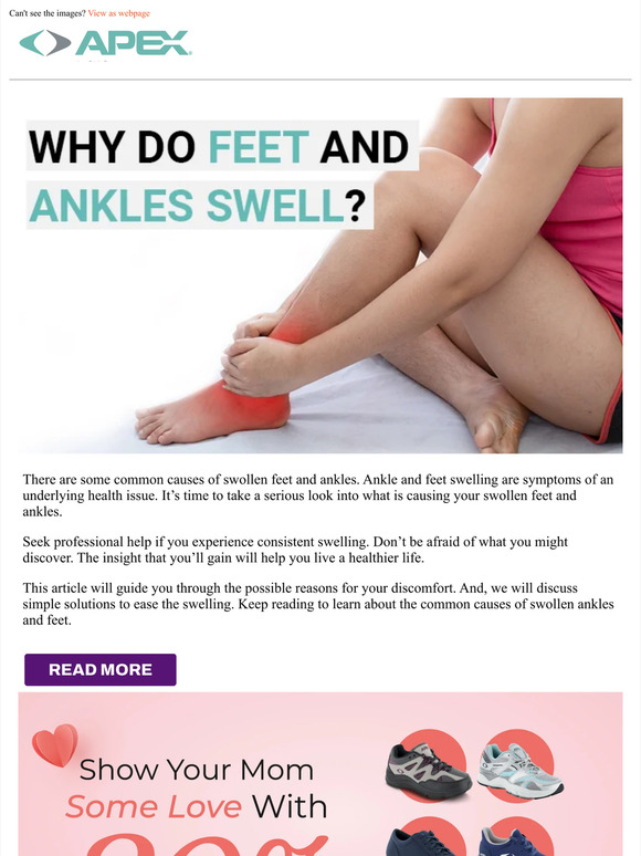 Apex Foot: The Causes of Swollen Ankles and Feet 🦶 | Milled