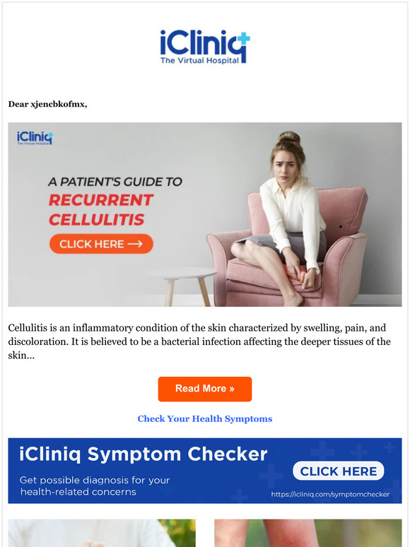 iCliniq: How to Treat and Prevent Recurrent Cellulitis? | Milled