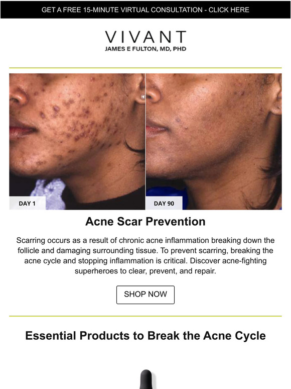 Vivant Skin Care: Control acne to prevent scarring | Milled