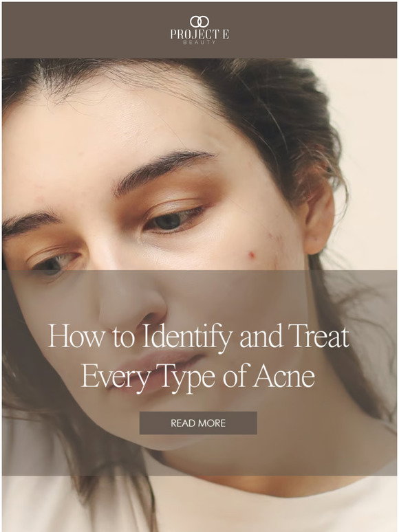 Project E Beauty: 🤔 How to Identify and Treat Every Type of Acne | Milled