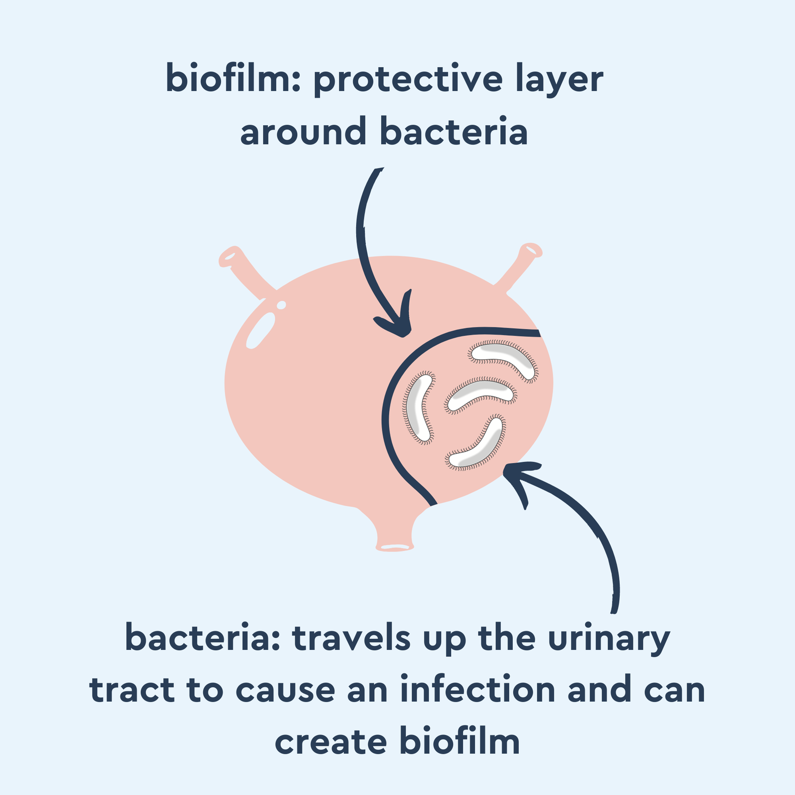 Uqora: How biofilm can impact your urinary tract | Milled