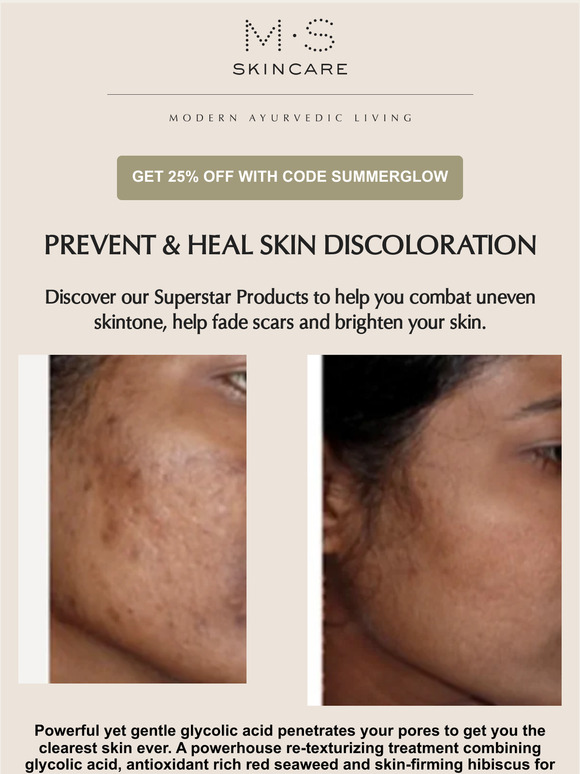 M.S Skincare: Reveal Radiant Skin: Ayurvedic Solutions for ...