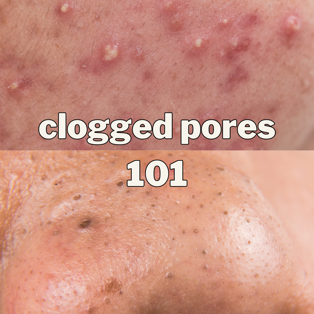 Cocokind: humid weather = clogged pores | Milled