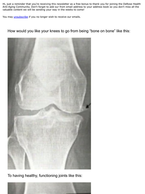 DeRose Health: New “Knee Candy” Rejuvenates Stiff, Achy Joints | Milled