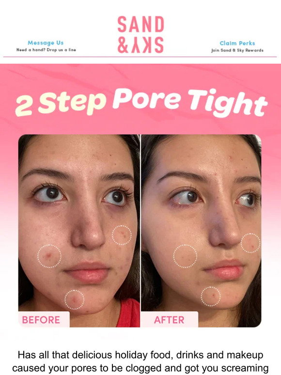 Sand & Sky: Clogged pores? Try this 2-step routine | Milled