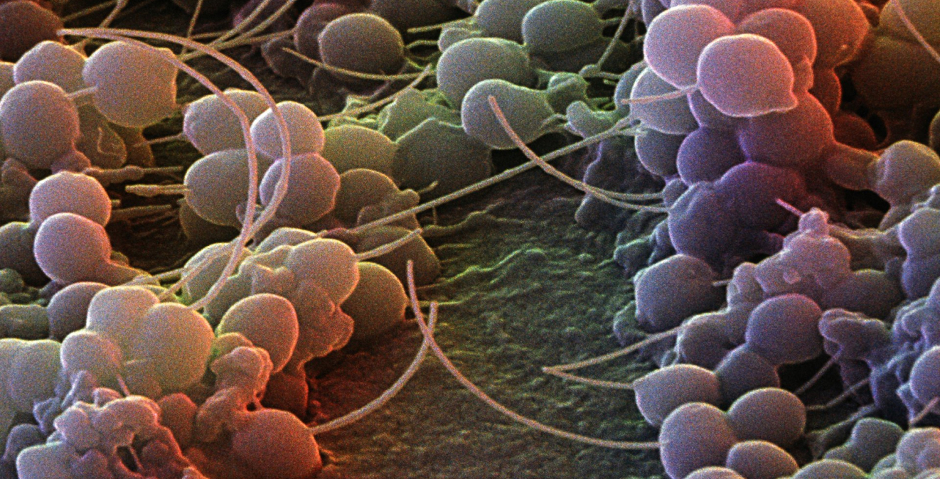 Elysium Health: The Abstract: Repeated sun exposure and cancer risk ...