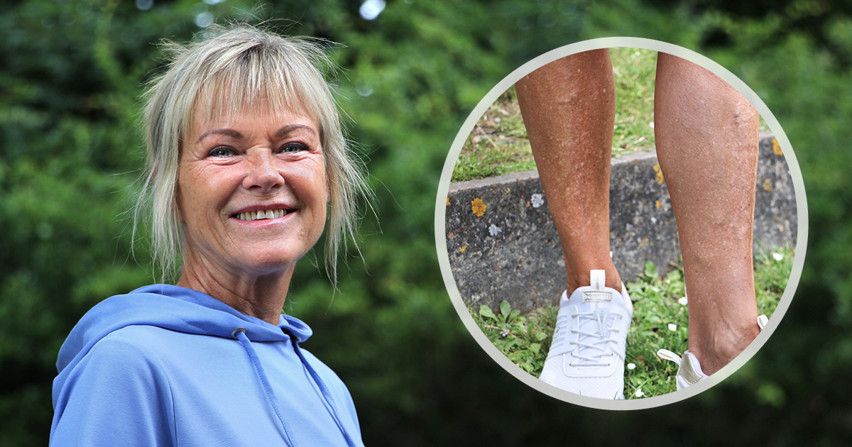 Wellvita: Hulp voor mijn blauwe aderen en zware benen | Milled