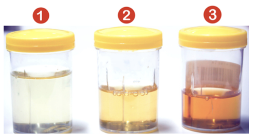 PaleoPlan: why the color of your morning pee is an important health ...