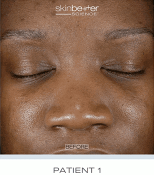 SkinBetter Science: Your chance to try our clinically proven skincare ...