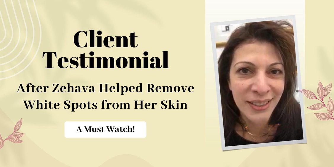 Gold Cosmetics: 👉How Zehava Restored Her Skin from White Spots? Watch ...