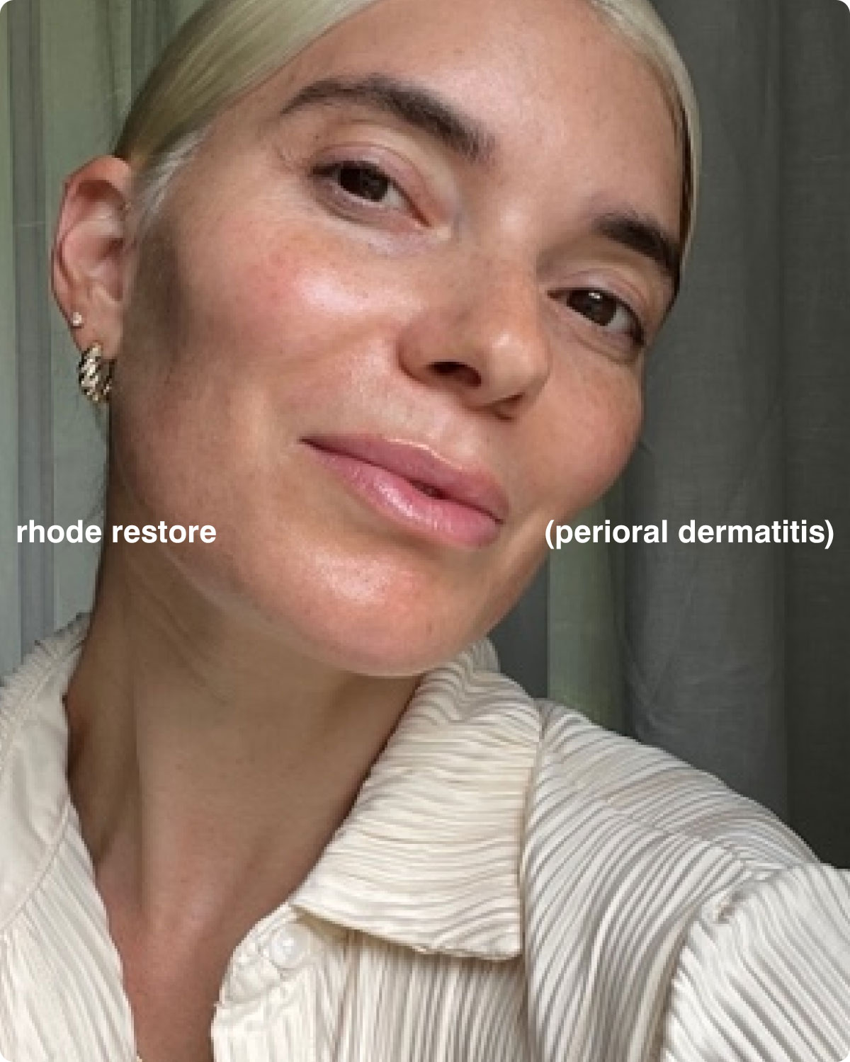 Rhode: rhode restore: perioral dermatitis | Milled