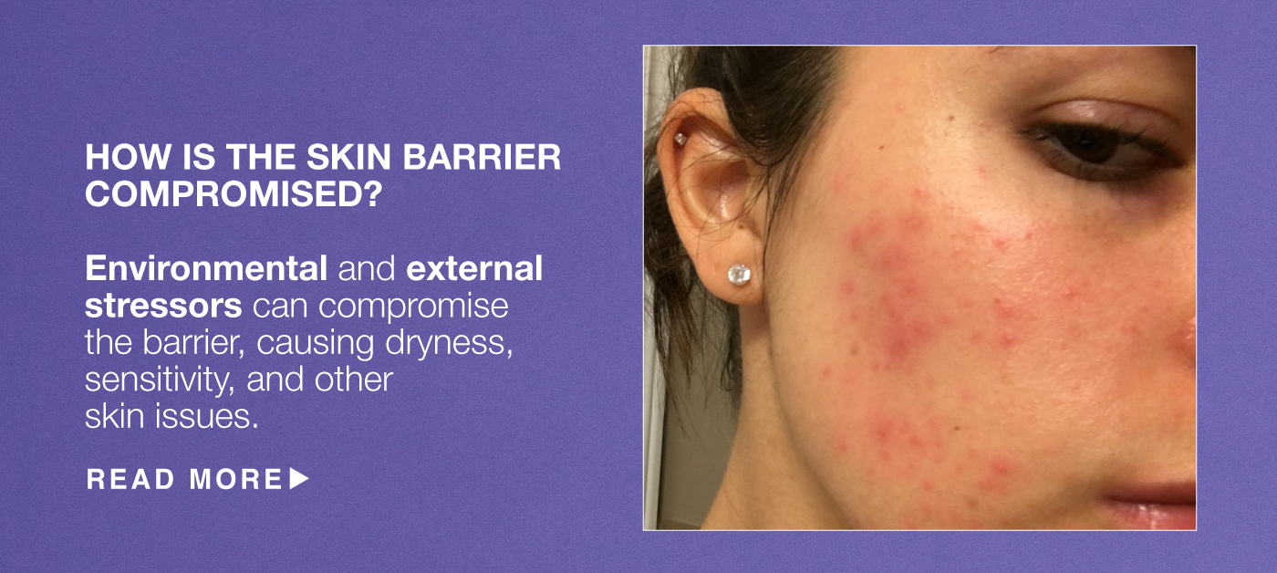 Dermalogica: What's the skin barrier? + Learn how to treat it | Milled