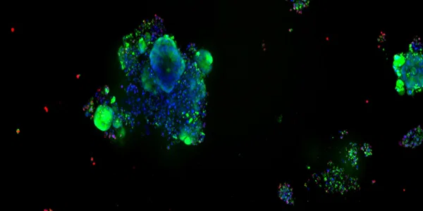 LabX: This application note details: Scaling up capacity for organoid ...