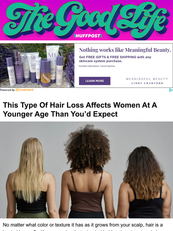 Devastee This Type Of Hair Loss Affects Women At A Younger Age Than