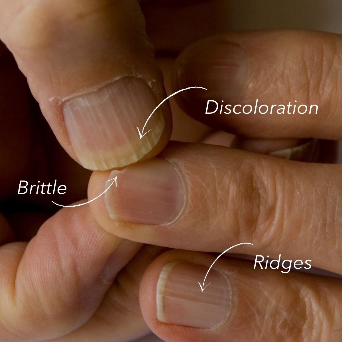 DefenAge: What do your fingernails say about your health? 🔊 💅 | Milled