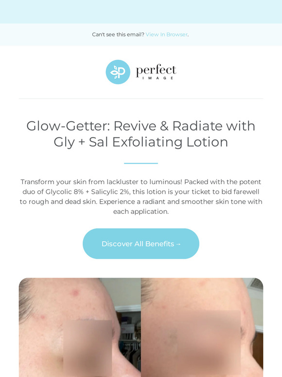 Perfect Image: Rough, Dead & Dull Skin On Body And Face? | Milled