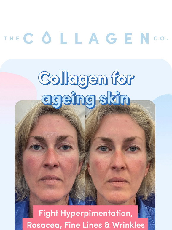 The Collagen Co.: Skin Transformation in JUST 7 DAYS 😍 | Milled