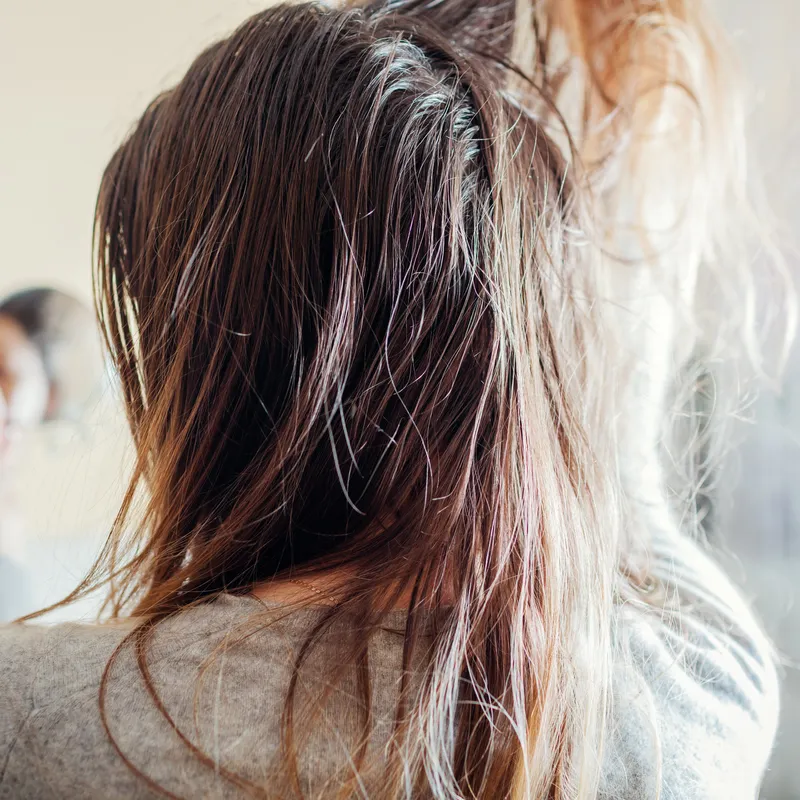 Glamour: How to Treat and Prevent Greasy Hair, According to Experts ...