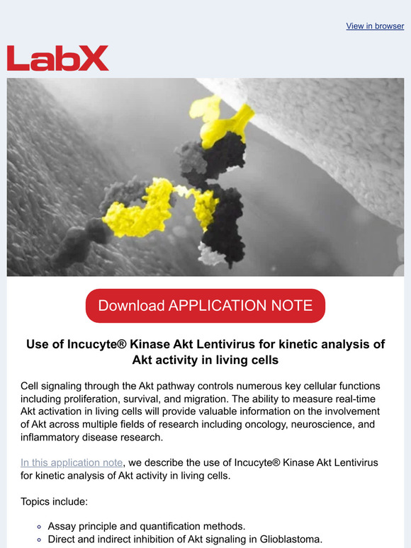 LabX: Use of Incucyte® Kinase Akt Lentivirus for kinetic analysis of Akt activity in living ...