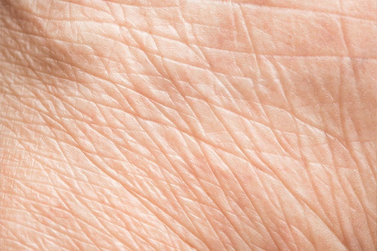 Immunocorp: $30 IMMUDERM®—Ends Soon | Milled