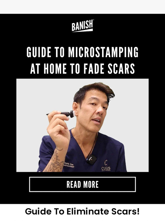Banish: Guide To Fading Scars At Home! | Milled
