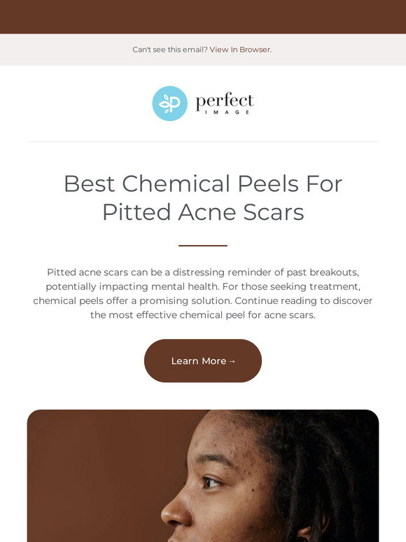 Perfect Image: Pitted Acne Scars? Take Back Control → | Milled