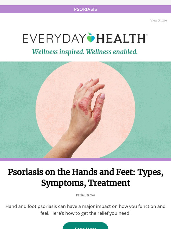 LIfescript: Psoriasis on the Hands and Feet: Types, Symptoms, Treatment ...