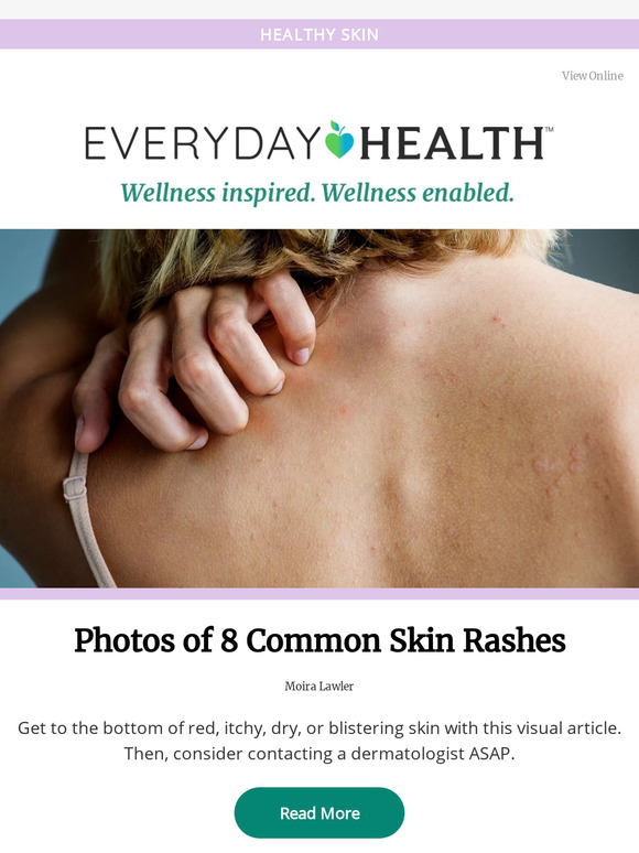 Lifescript: Photos of 8 Common Skin Rashes | Milled
