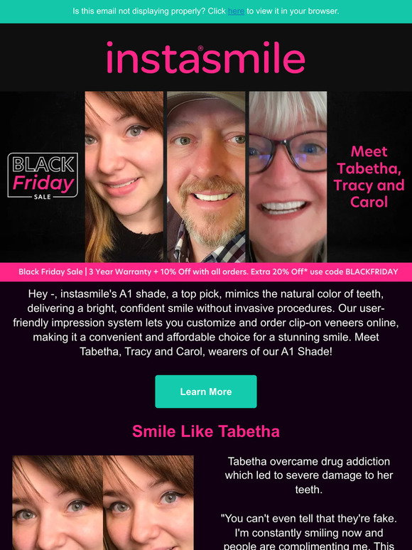 INSTAsmile (UK): Hey —, Check Out These Smile Transformations 🪄 | Milled