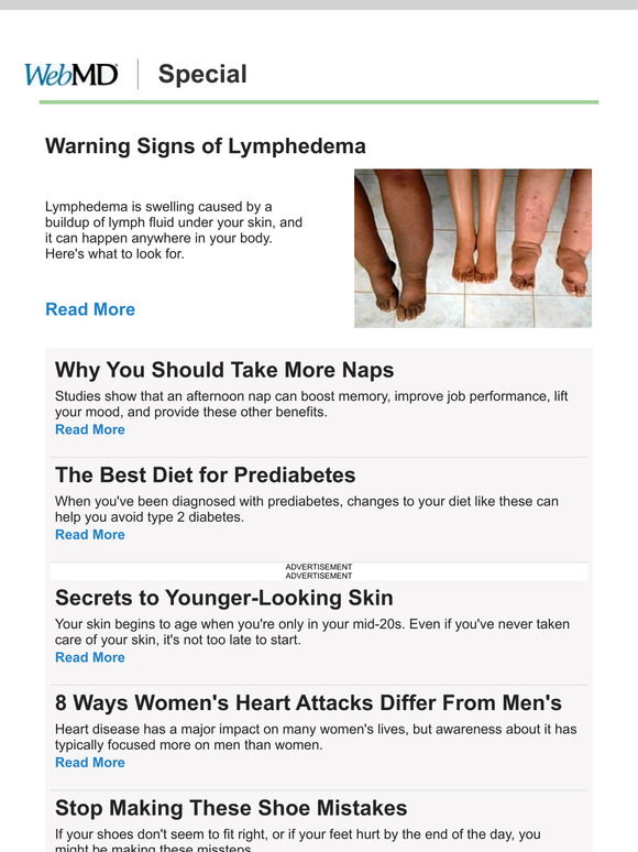 Somaderm Gel Side Effects: Warning Signs of Lymphedema | Milled