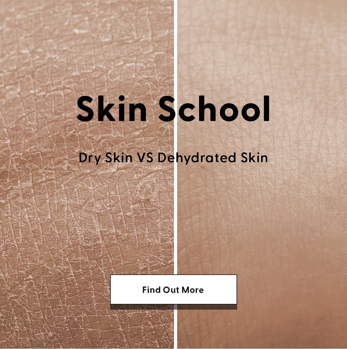 Stratia: Dry Skin VS Dehydrated Skin | Milled