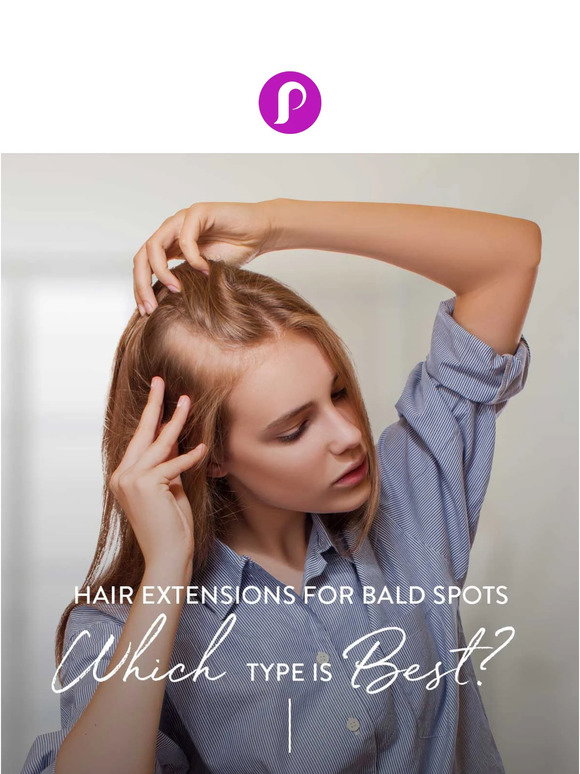 Perfect Locks: Bald Spots Beware: Meet Your Match 💇‍♀️ | Milled