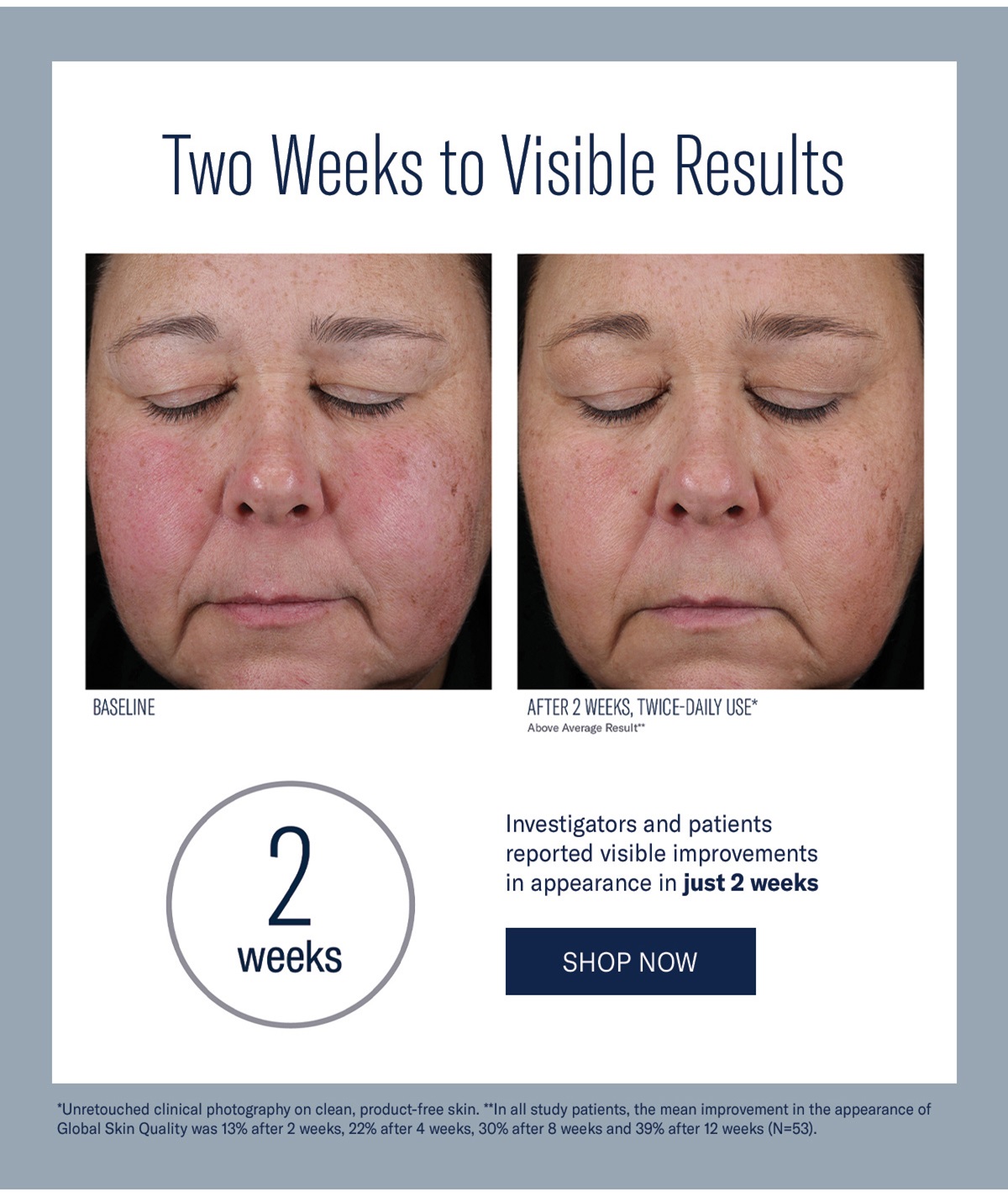 SkinBetter Science: 💕More to Love About Mystro Active Balance Serum ...